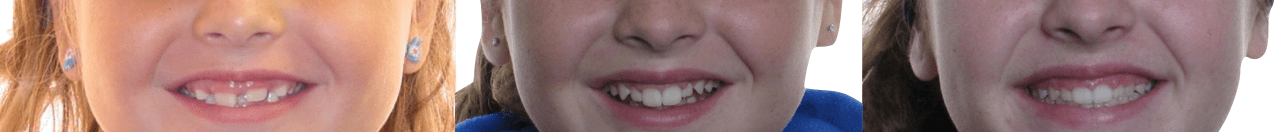 Case Study 40 – Development - Bandeen Orthodontics